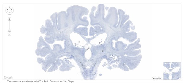 joeLAB.com: H.M.’s Brain